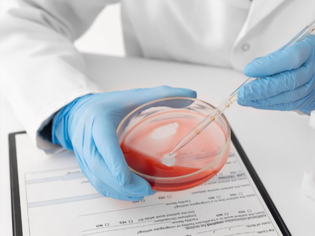 Biotiquín informa, actualidad sobre el caroteno, un protector natural ...